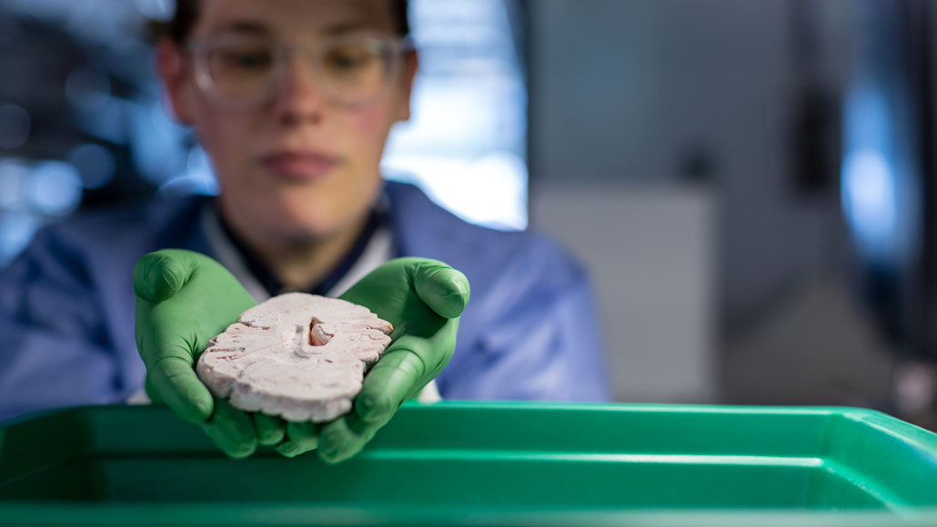 What Human And Mouse Brains Do And Dont Have In Common