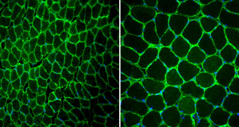 Steroids boost muscles for the long haul