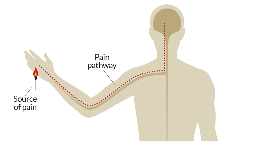 Anatomy Of Pain