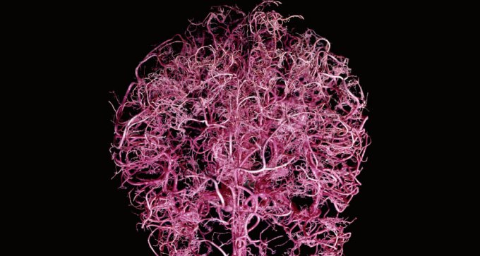Blood exerts a powerful influence on the brain