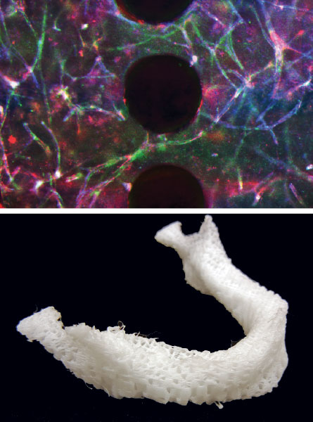 Cells from fat mend bone, cartilage, muscle and even the heart