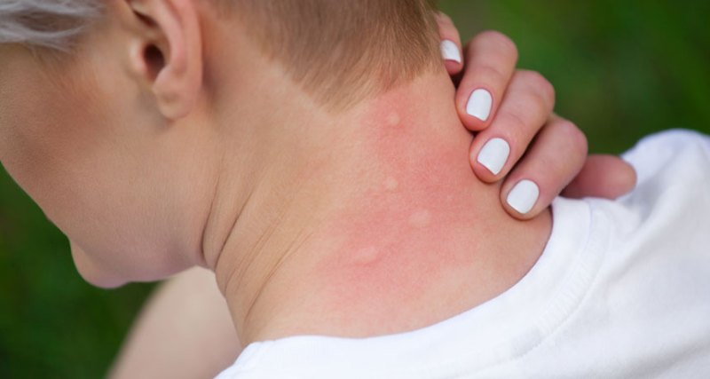 How an itch hitches a ride to the brain