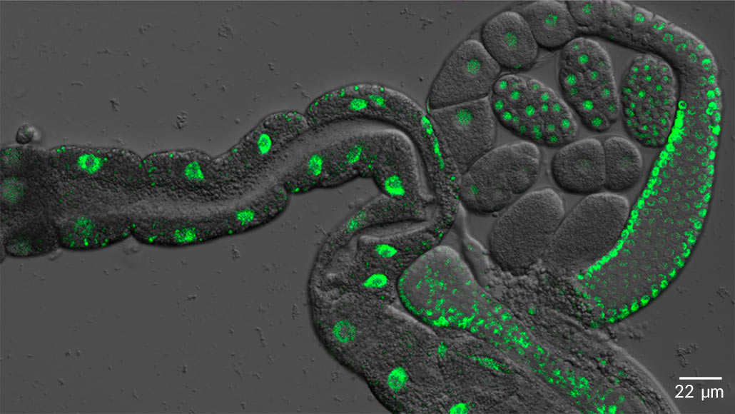 This gene may help worms live longer, but not healthier