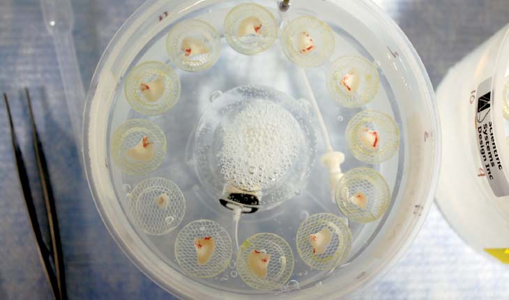 How pieces of live human brain are helping scientists map nerve cells