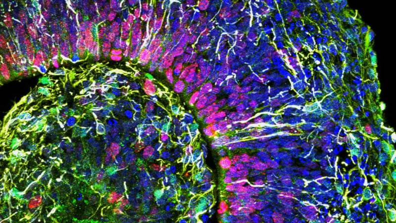 Clumps of cells in the lab spontaneously formed brain waves