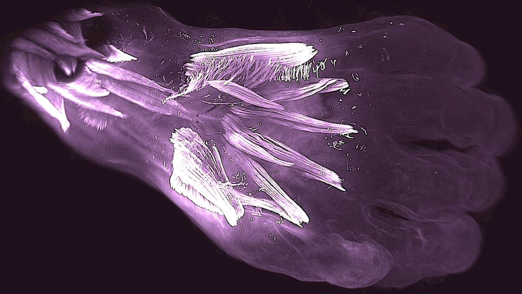 Human embryos have hand muscles found in lizards but not most adults ...