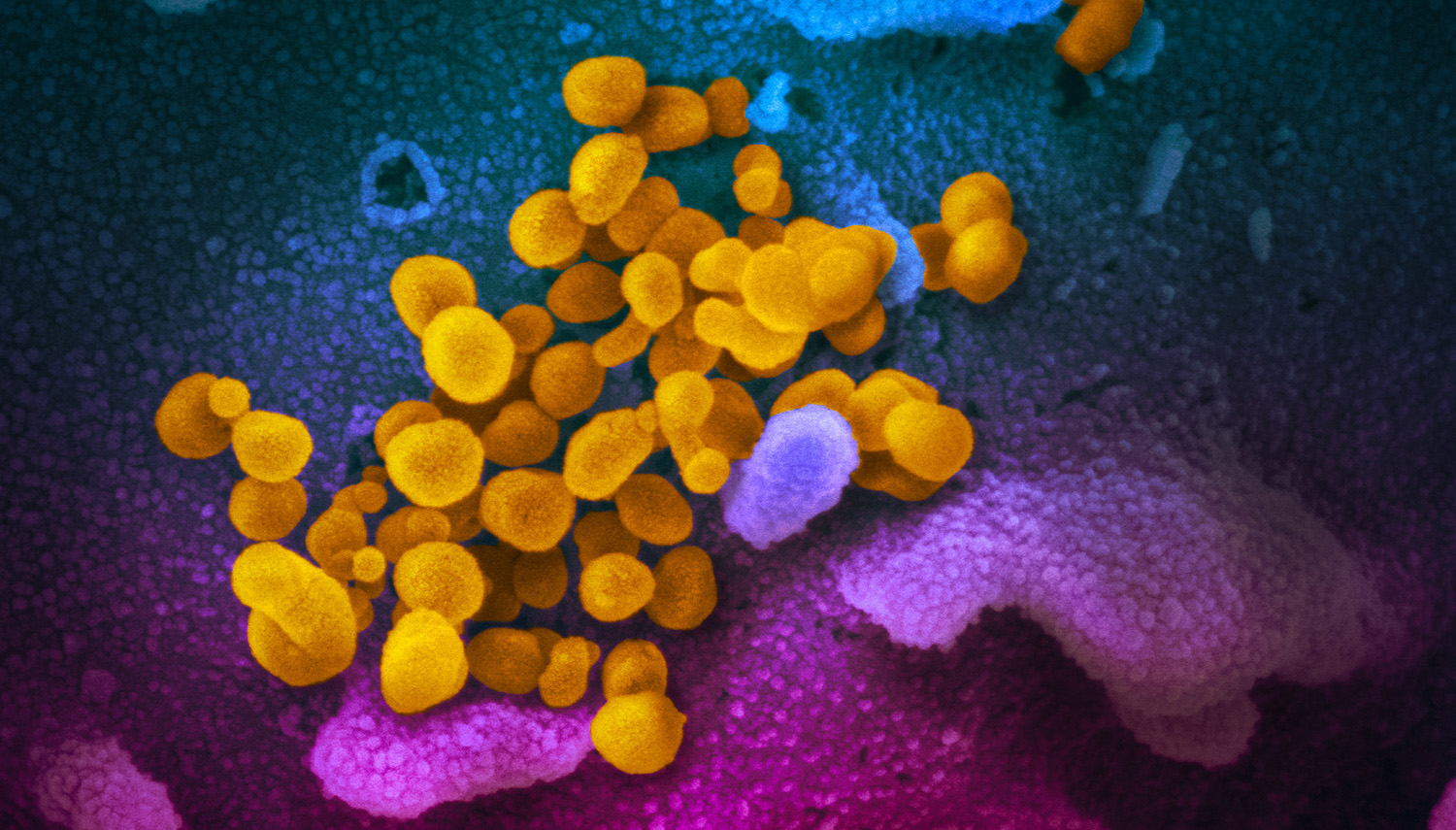 The Coronavirus Pandemic | Science News