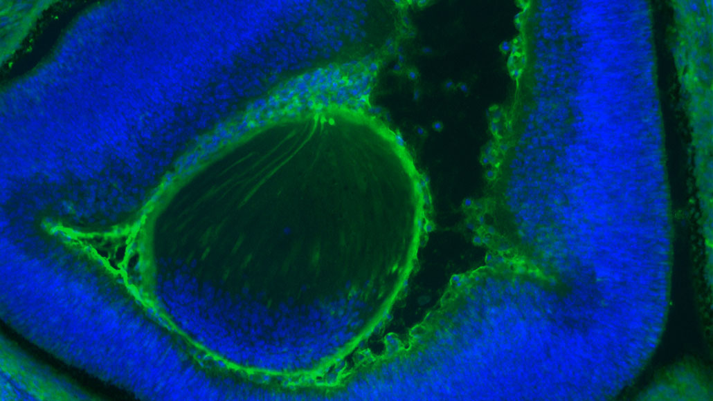 New hybrid embryos are the most thorough mixing of humans and mice yet