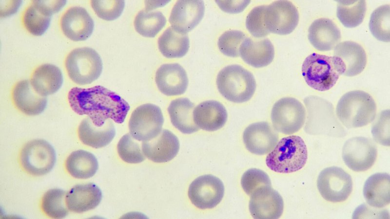 How malaria parasites hide from the human immune system