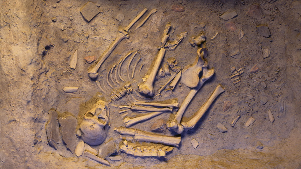 Some Neandertal genes in people may help prevent severe COVID-19 ...