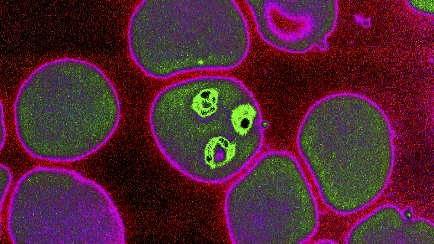 A malaria vaccine with live parasites shows promise in a small trial