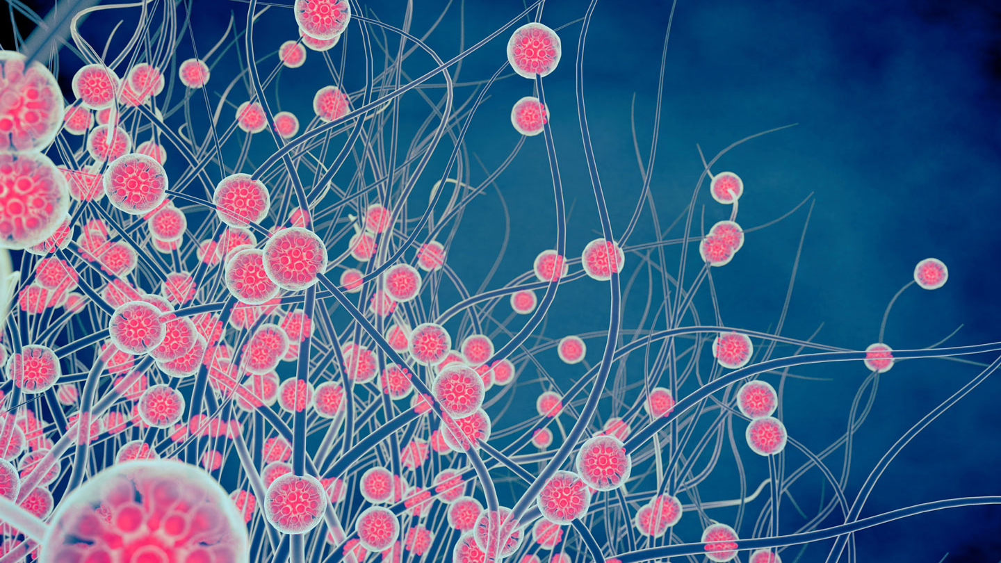 4 key things to know about lung infections caused by fungi
