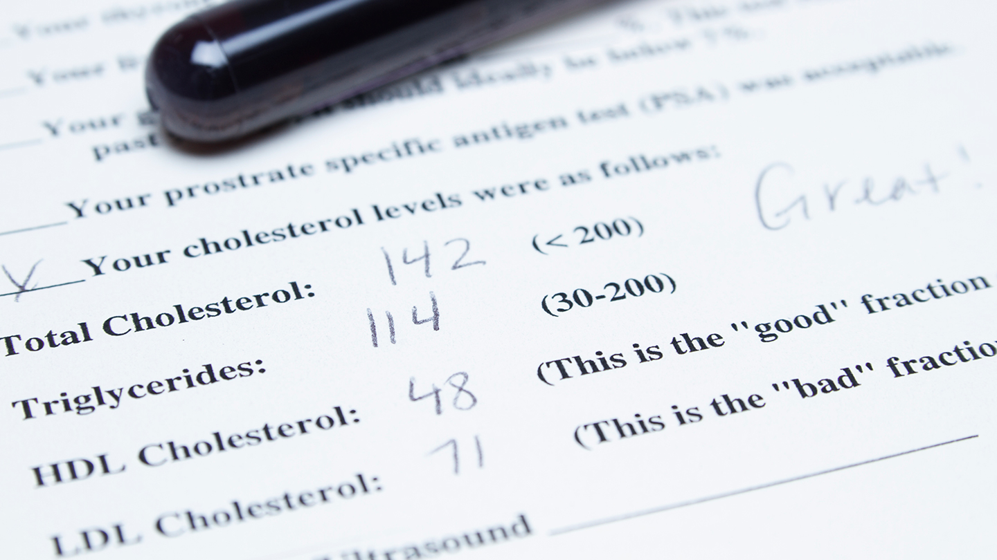 HDL ‘good’ cholesterol isn’t always good for heart health
