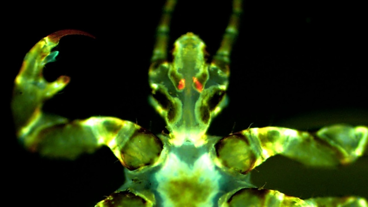 Human body lice could harbor the plague and spread it through biting