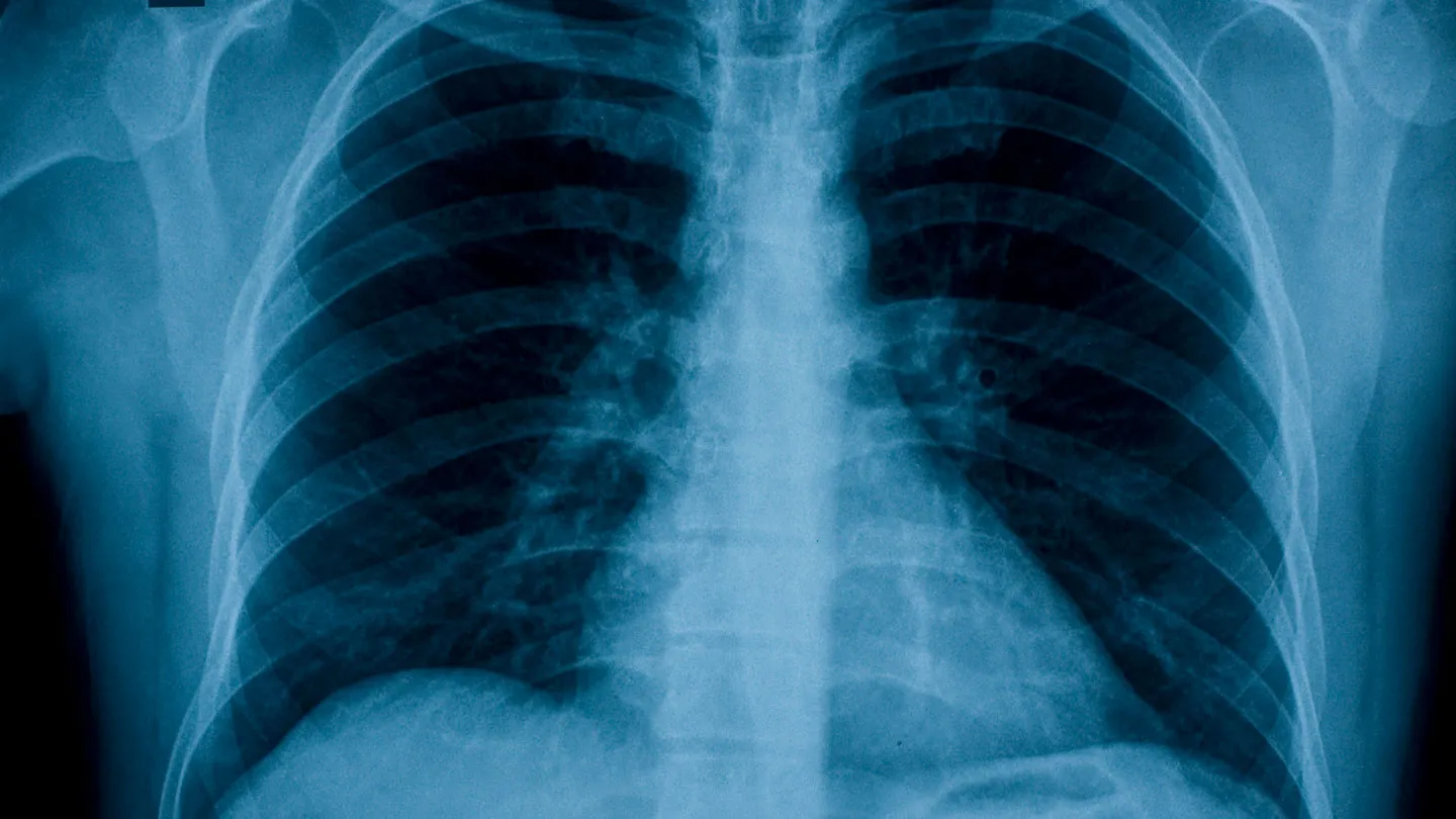 AI could take medical imaging to the next level