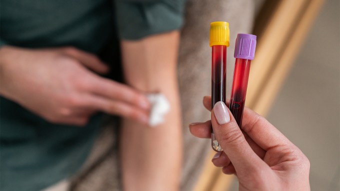 Sepsis tests take days, putting patients at risk. A new method may cut ...