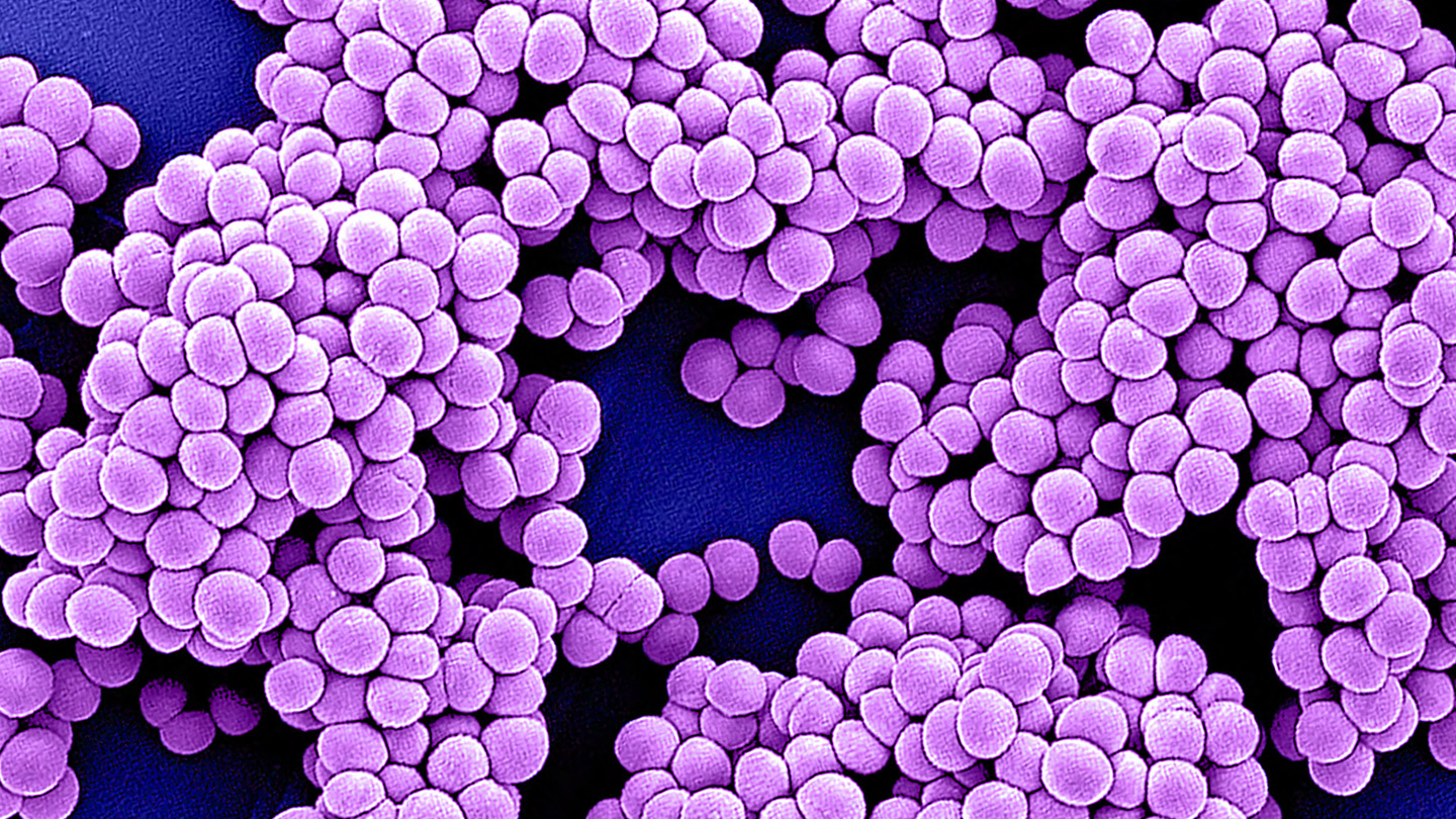 50 years ago, antibiotic resistant bacteria became a problem outside ...