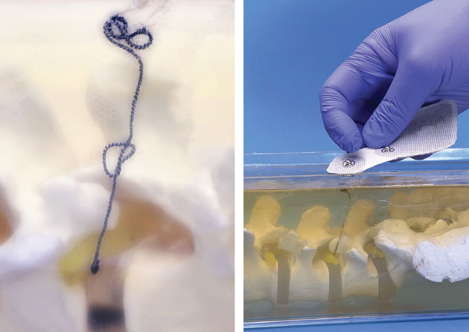 A next-gen pain drug shows promise, but chronic sufferers need more options