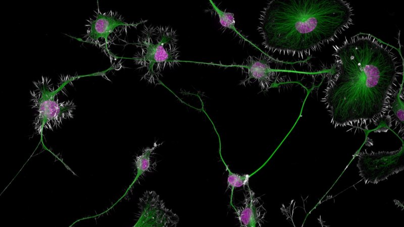 Here are some stellar picks from Nikon’s top microscopy images of 2024