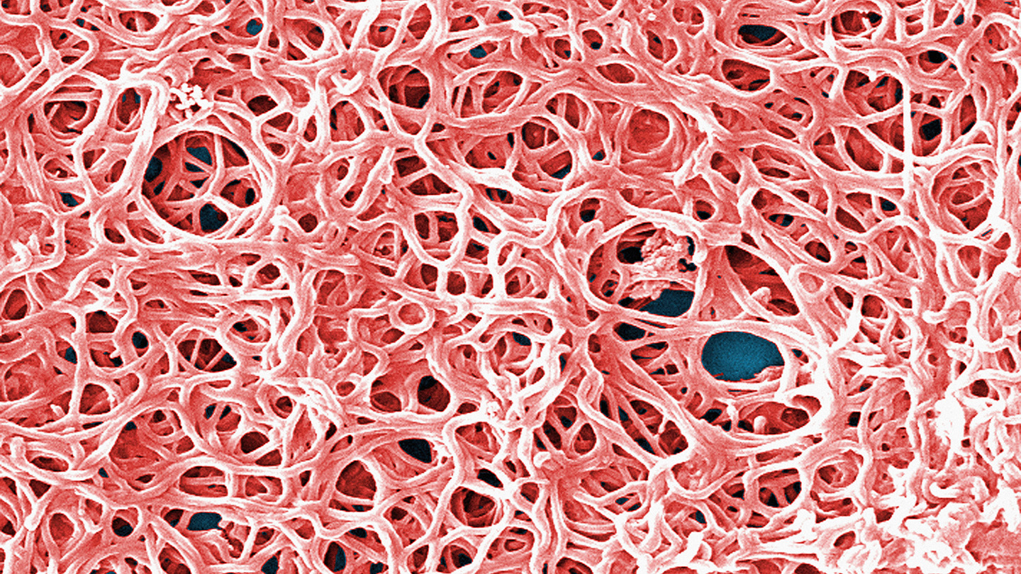 How to fight Lyme may lie in the biology of its disease-causing bacteria
