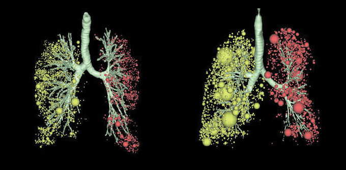 See how fractals forever changed math and science