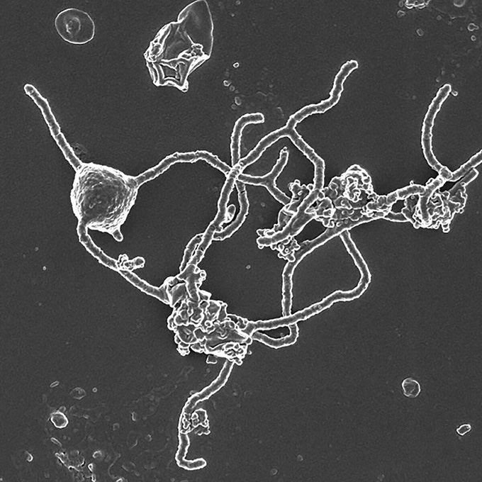 How these strange cells may explain the origin of complex life