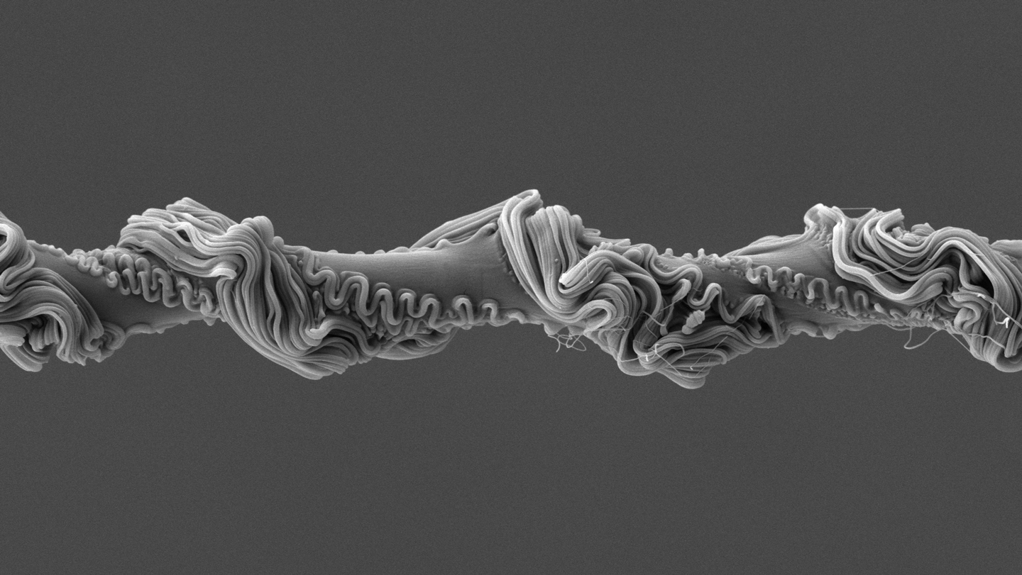 The Brazilian flea toad may be the world’s smallest vertebrate